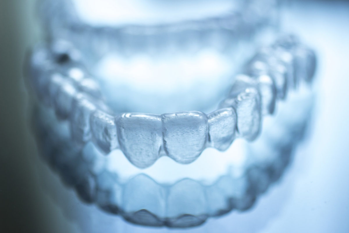 Advantages of Invisalign - Angel Care Dental